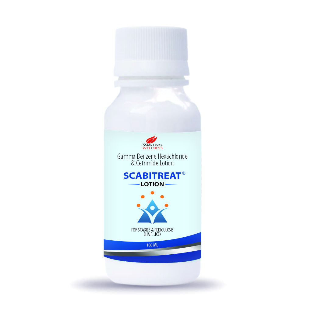 Scabitreat Lotion 100 ML - Smartway